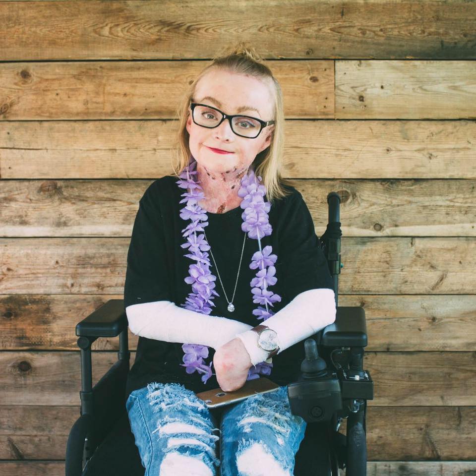 Kourtney Kujawa – DEBRA Canada